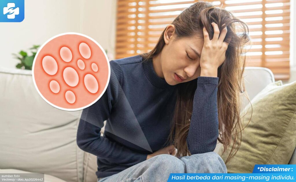 5 Faktor Risiko Sifilis pada Wanita Remaja yang Perlu Diwaspadai