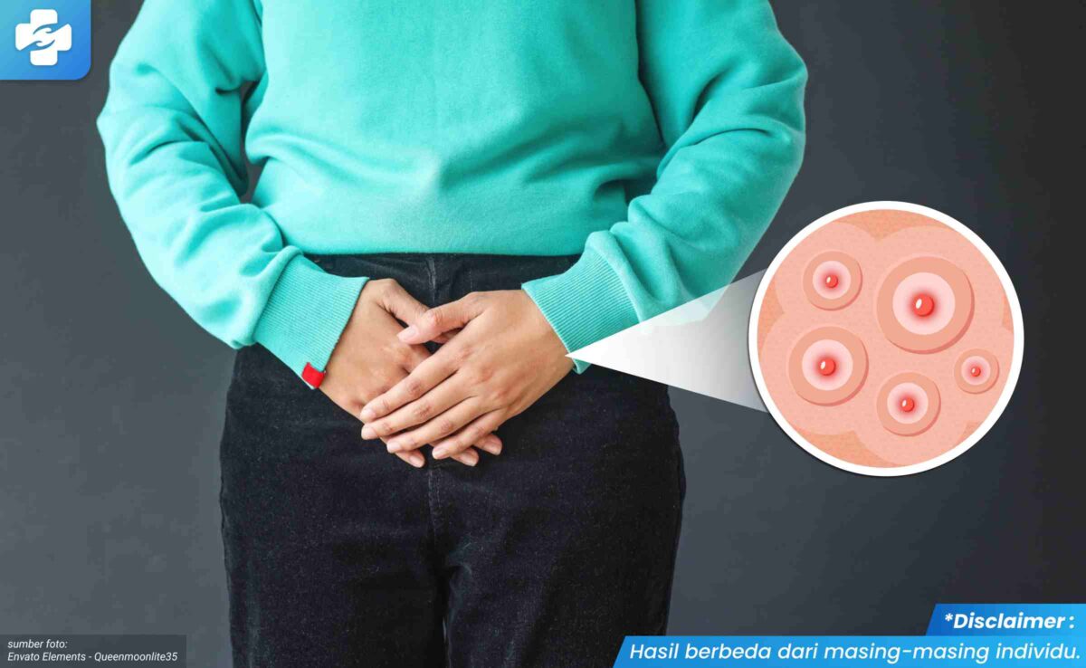 Jerawat di Kemaluan Muncul Tiba-Tiba? Ternyata ini Penyebabnya!